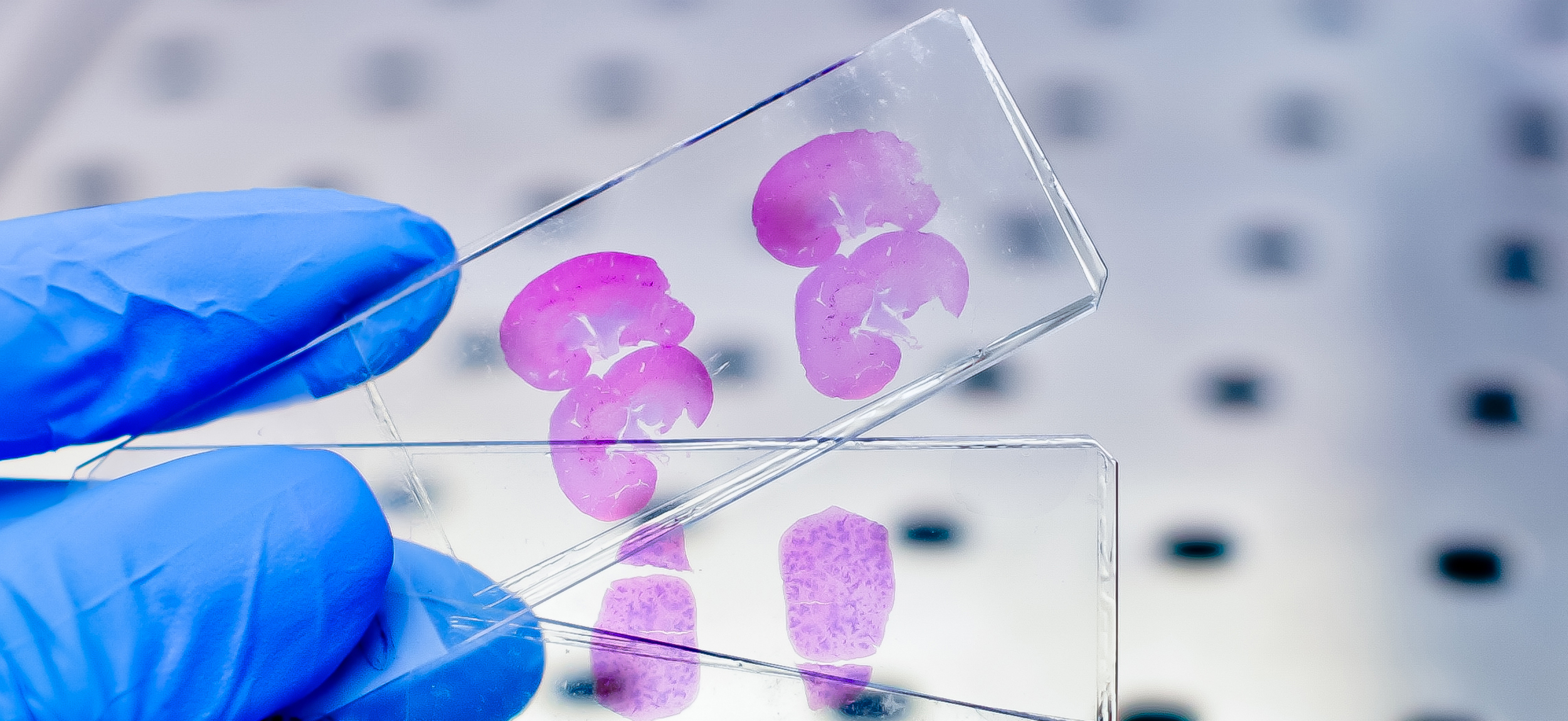 Automatic Nuclei Segmentation and Tumour Cellularity Assessment in ...